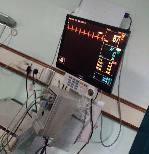 Apa itu Elektrokardiogram | Jenis Mesin Tes EKG/ ECG Jantung